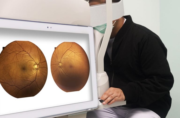 what-is-a-diabetic-eye-exam-calgary-didsbury